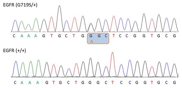 EGFR Wild Type Reference Standard 1 FFPE curl